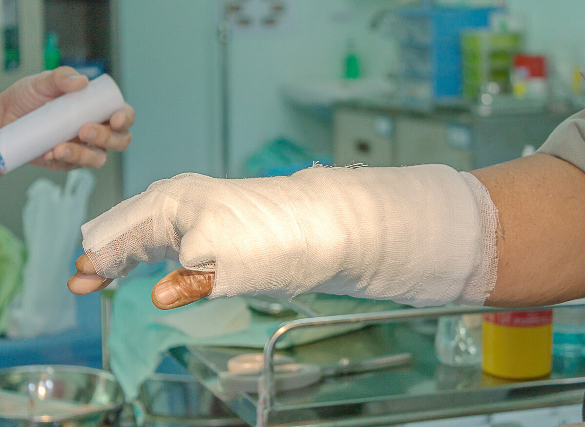 Burn Injuries Take Time to Heal - How Much Can You Recover From Your Claim?